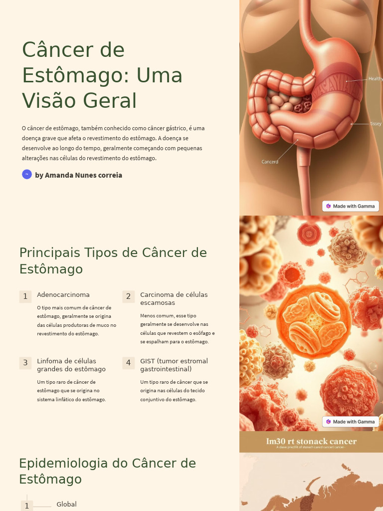 Câncer de Estômago: Sintomas e Tratamentos | PDF | Câncer ...