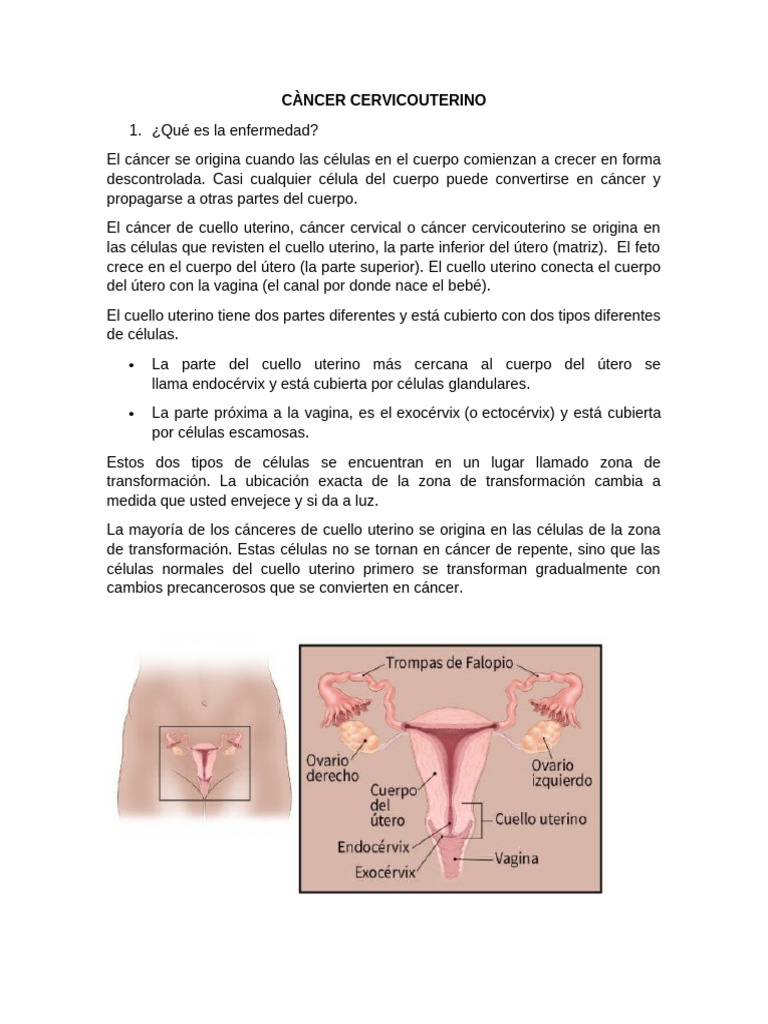 Càncer Cervicouterino | PDF | Cáncer de cuello uterino | Cáncer