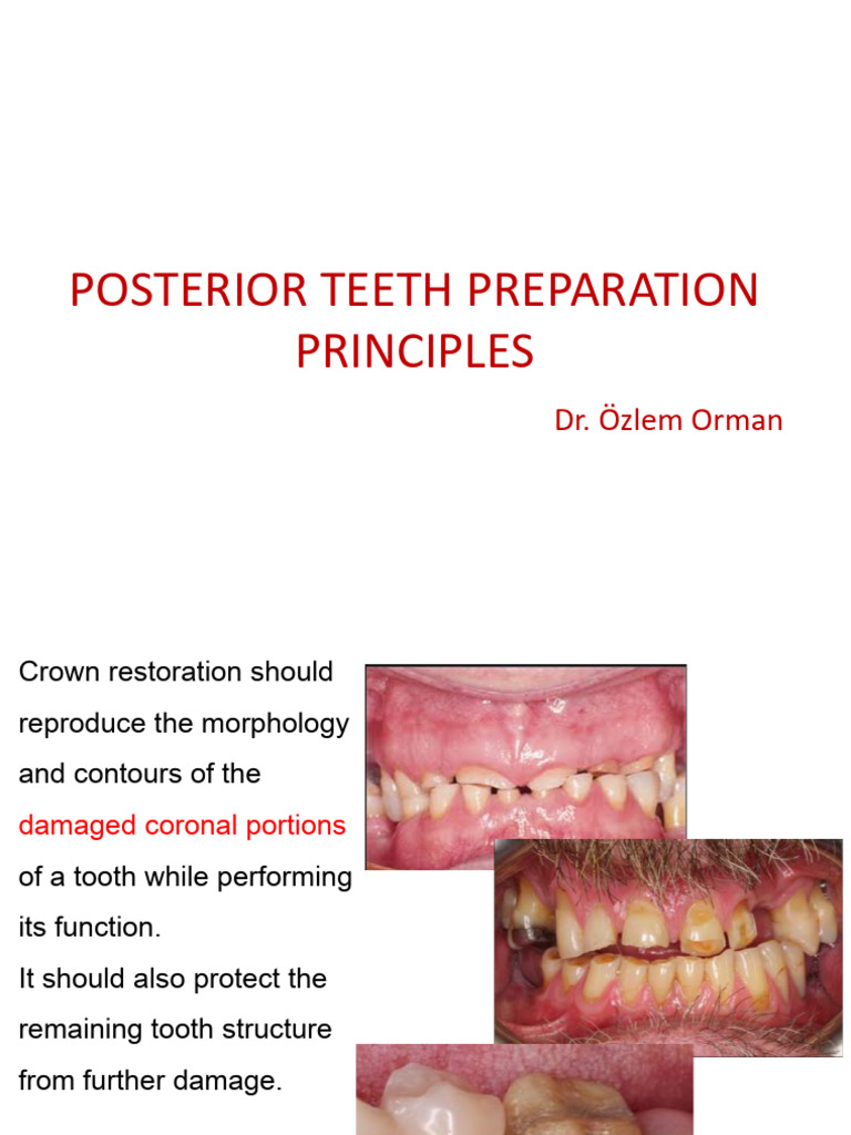 Posterior Tooth Preparation Principles | PDF | Dentistry Branches ...