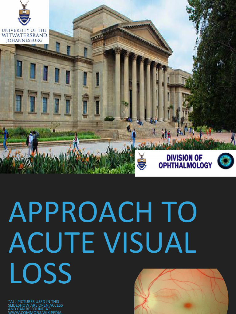 Acute Visual Loss: Diagnosis & Management | PDF | Glaucoma | Ophthalmology