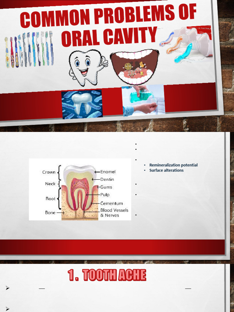 Module 1 Common Problems of Oral Cavity - 5 | PDF | Candidiasis | Human ...