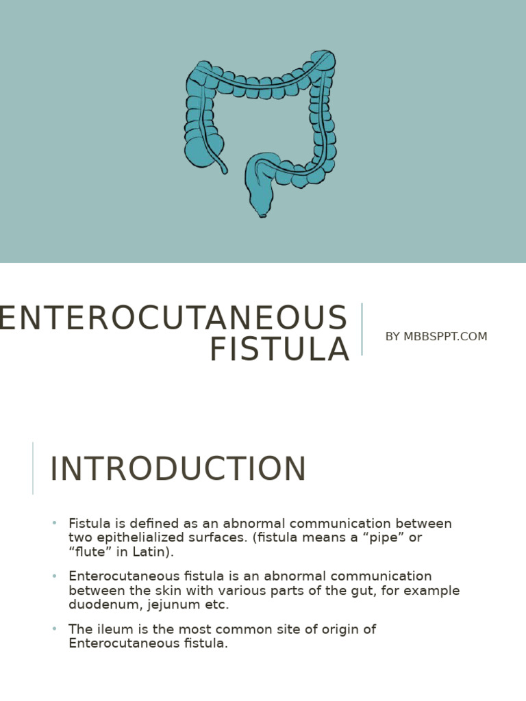 Enterocutaneous Fistula | PDF | Crohn's Disease | Sepsis