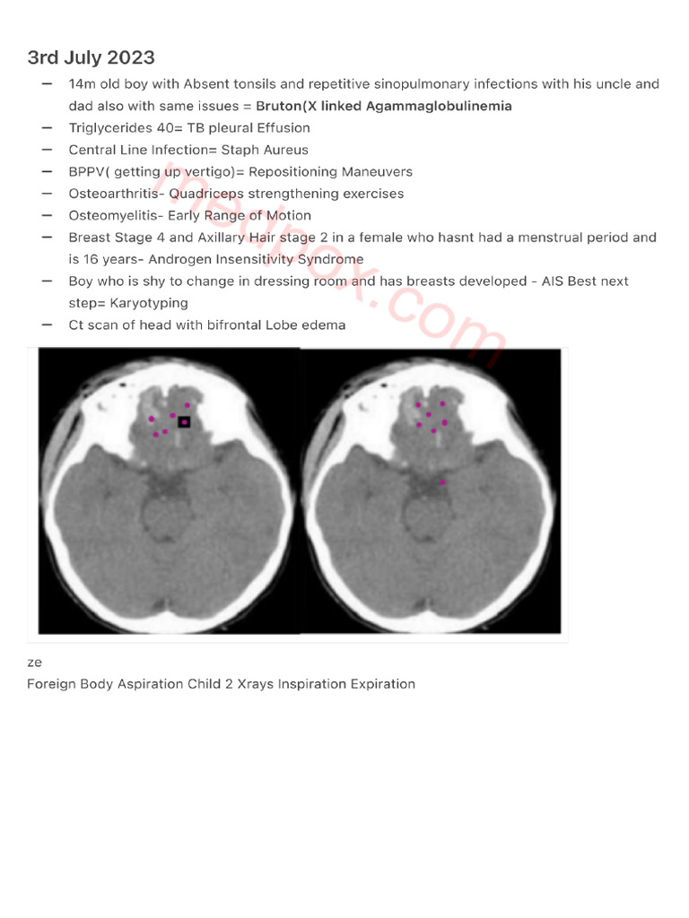 Step 2 CK 28 July 2023 Recalls by (Medicalstudyzone - Com) | PDF