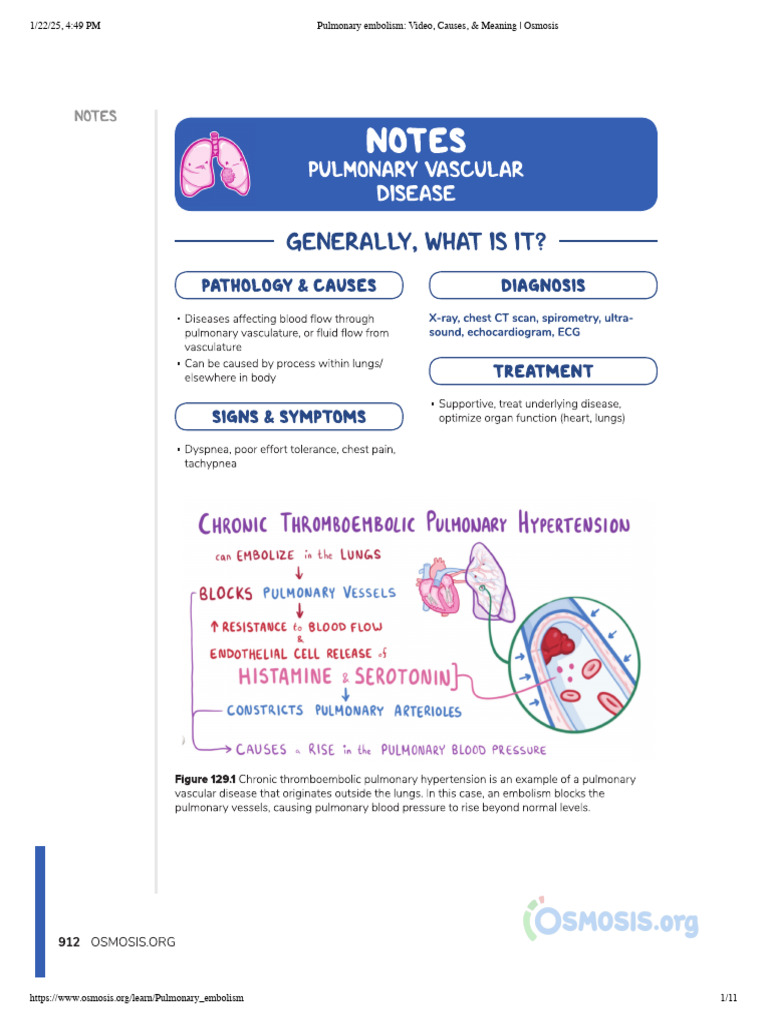Pulmonary Embolism - Video, Causes, & Meaning - Osmosis | PDF