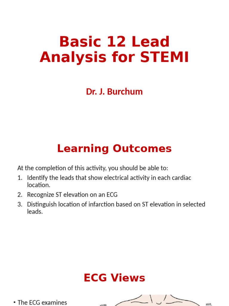 STEMI 12 Lead ECG Analysis Guide | PDF | Electrocardiography | Visual ...