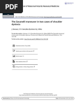 Zavanelli Maneuver for Shoulder Dystocia | PDF | Childbirth | Caesarean ...