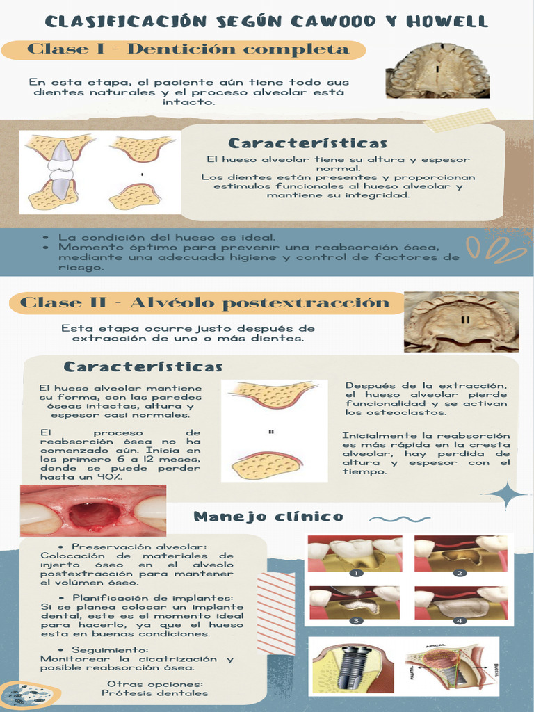 Clase I y II - Cawood y Howell | PDF