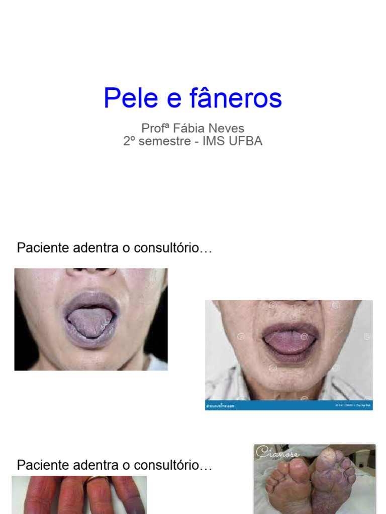 Exame Físico Da Pele e Dos Fanêros - Semiologia II 2 | PDF | Pele ...