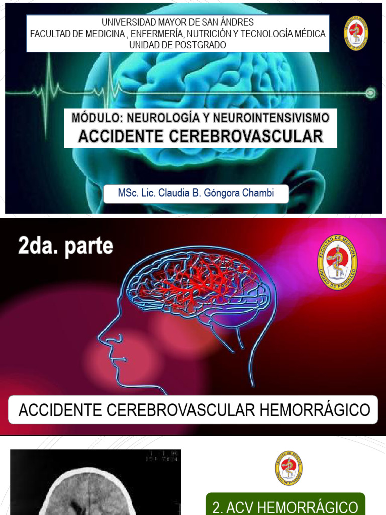 Guía sobre ACV Hemorrágico y Tratamientos | PDF | Carrera ...