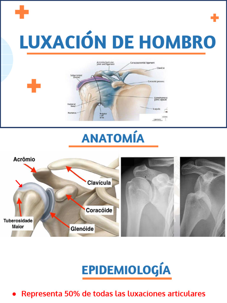 Resumo Luxacion Del Hombro Pdf Hombro Sistema Musculoesquelético