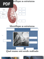 Exame de Esofagografia com Contraste | PDF | Vômito | Esôfago