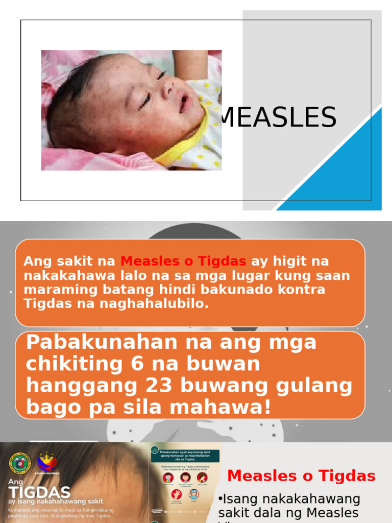 Measles | PDF