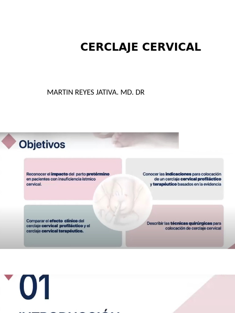 Cerclaje Cervical Modificado | PDF