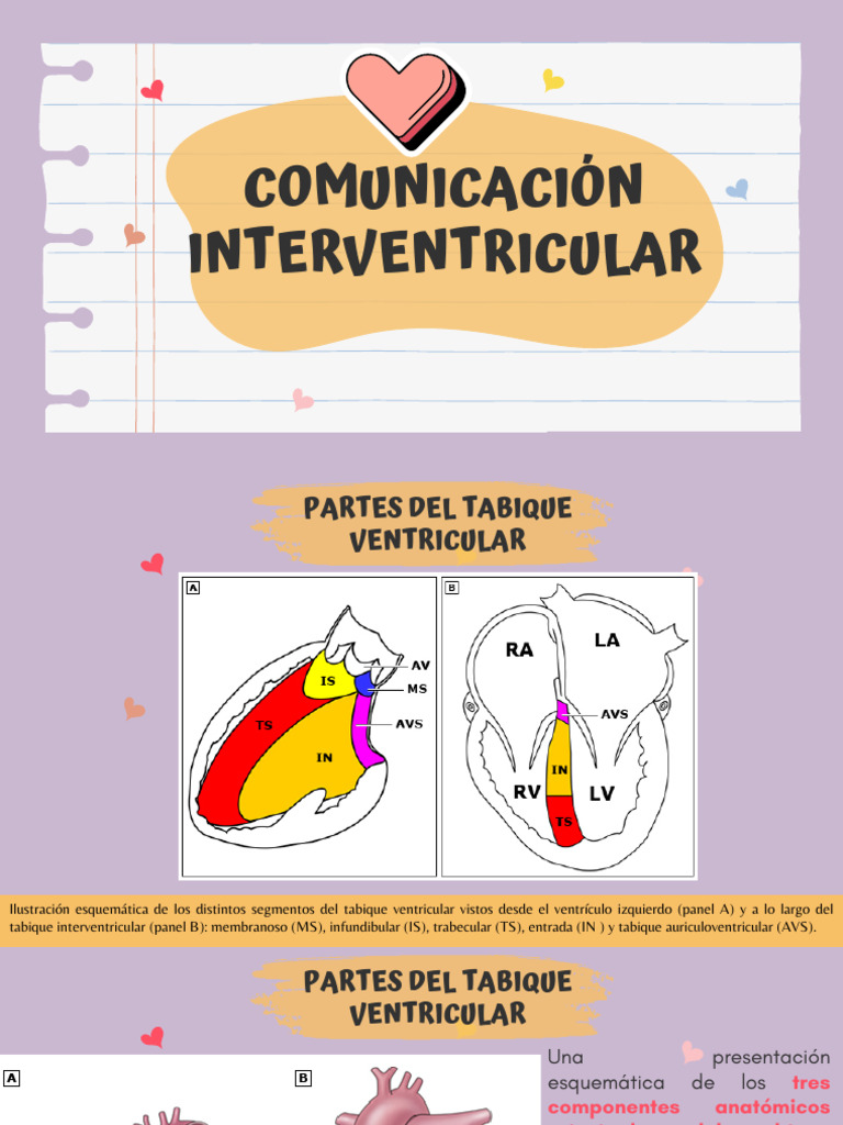 Comunicación Interventricular | PDF | Ventrículo (corazón) | Sistema ...