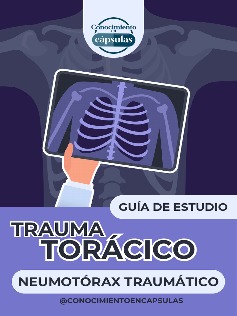 Neumotórax Traumático: Guía Completa | PDF | Tórax | Pulmón