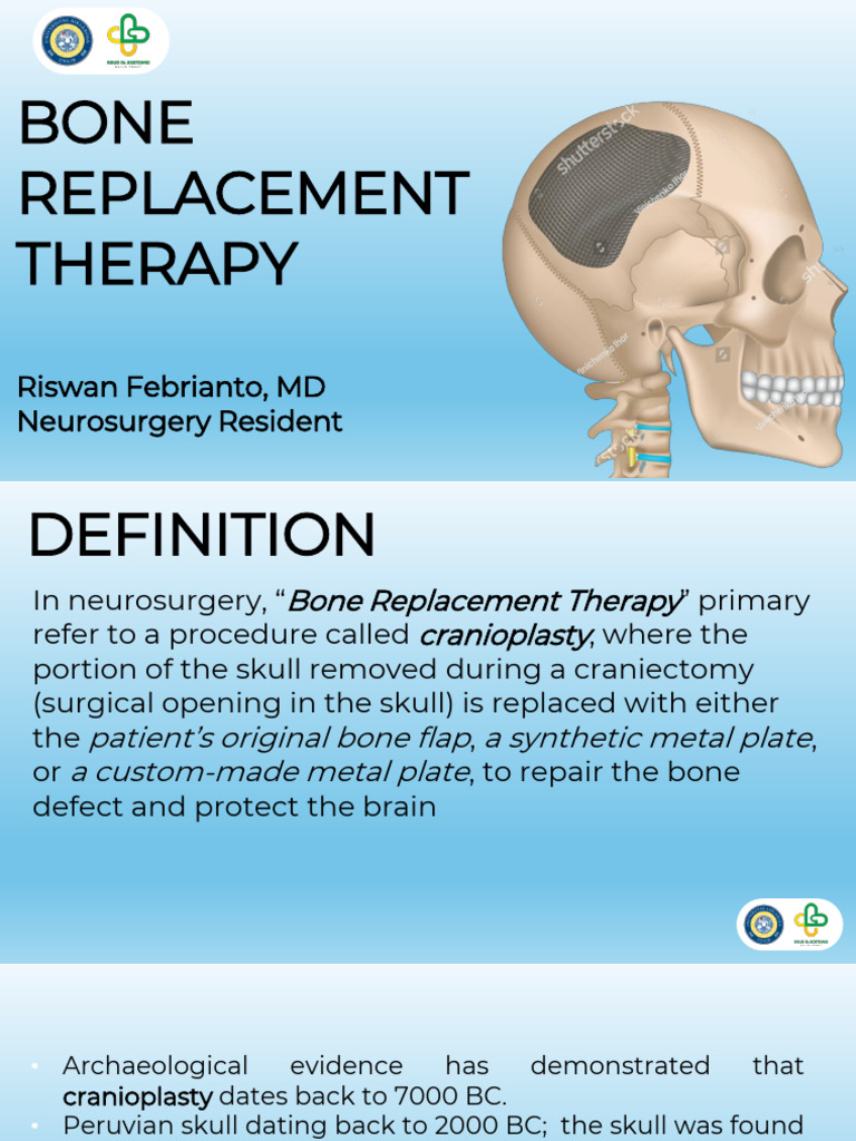 Bone Replacement Therapy - Riswan | PDF | Surgery | Medical Specialties