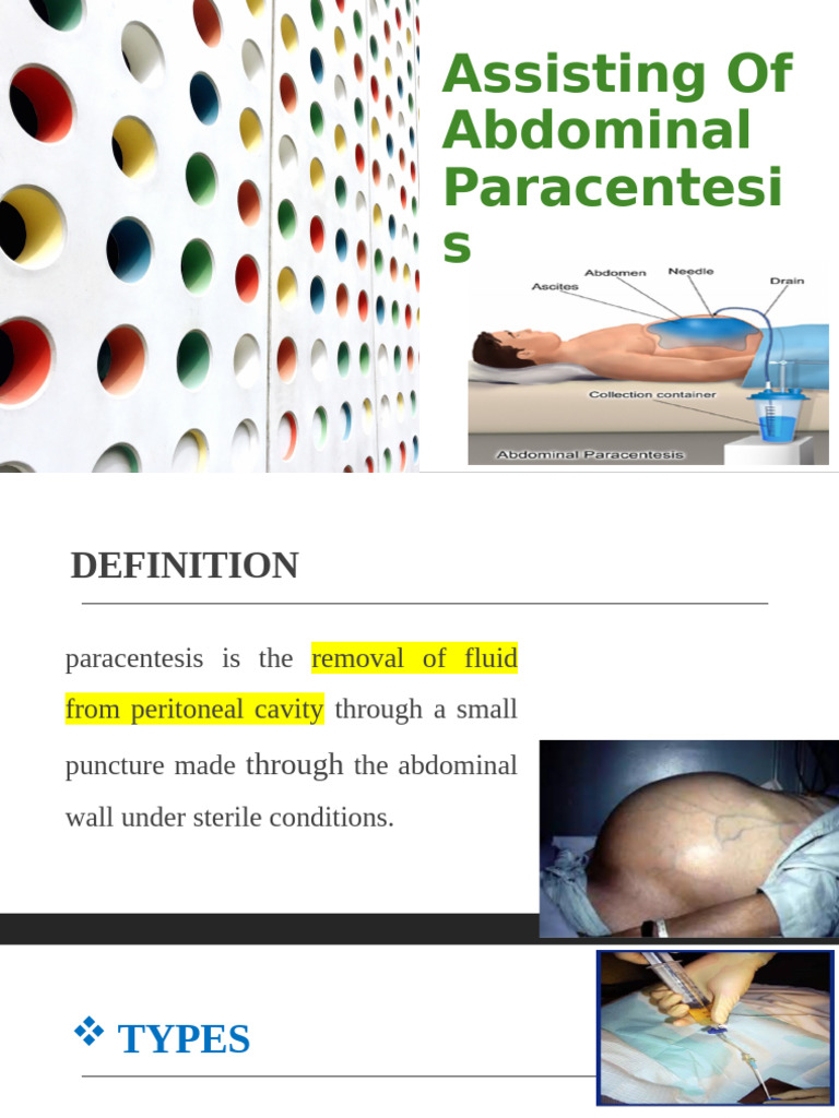 Assisting of Abdominal Paracentesis | PDF | Clinical Medicine | Medical ...