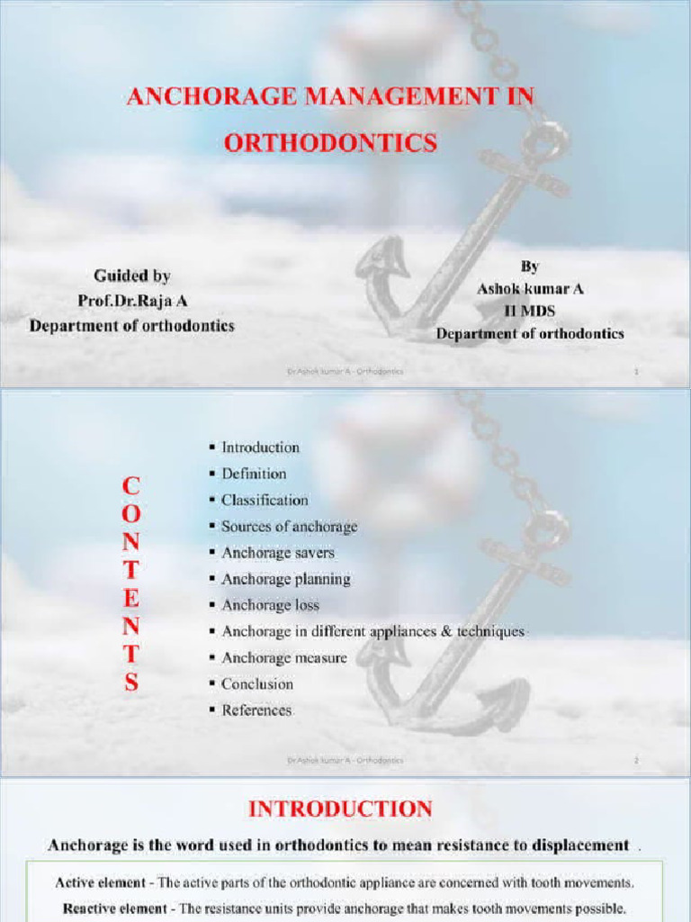Anchorage Management in Orthodontics | PDF