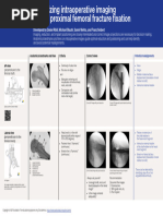 Anexo II - Mako THA CT Scanning Protocol | PDF | Pelvis | Knee