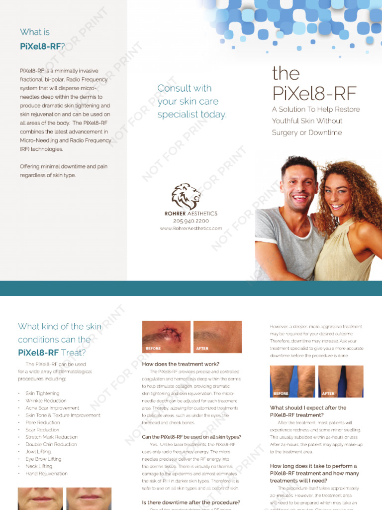 Pixel8 RF Patient Brochure | PDF