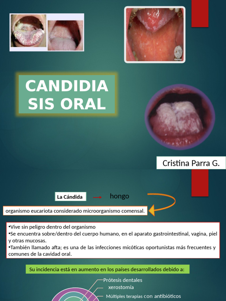Candidiasis | PDF | Candidiasis | Enfermedades y trastornos