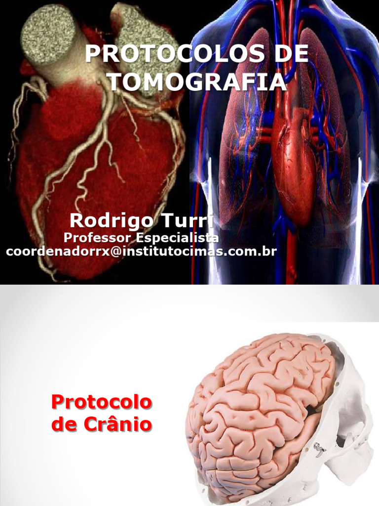 Protocolos de Tomografia | PDF | Estômago | Coluna vertebral