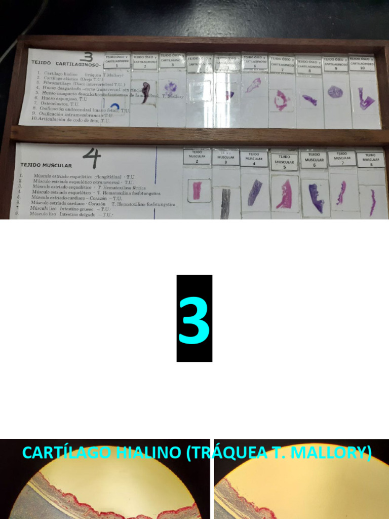 3-4 Cartil - Musculo | PDF