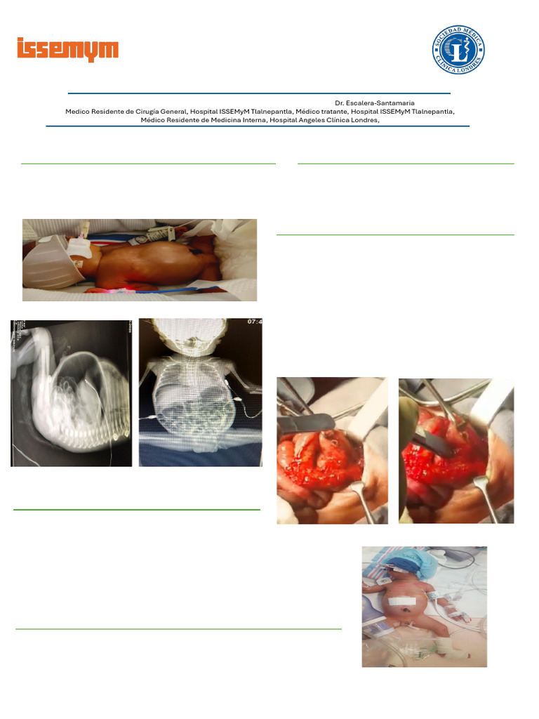 Final Perfo Gastrica | PDF | Medicina CLINICA | Enfermedades y trastornos