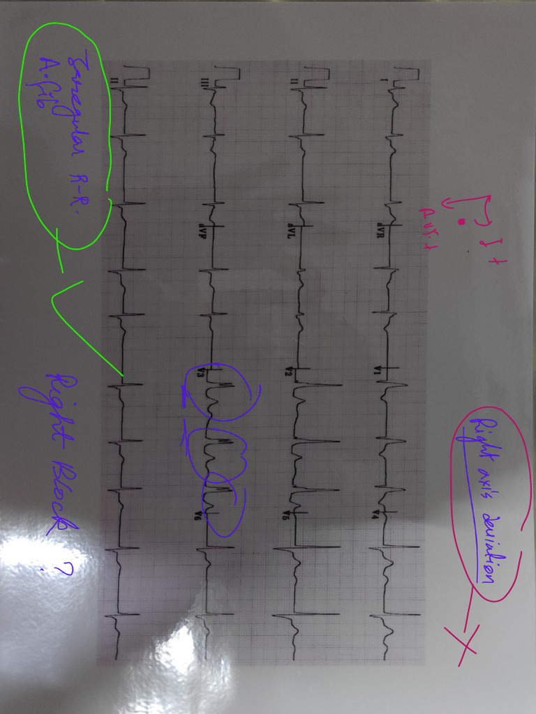 Ecg Exam 250309 115326 | PDF