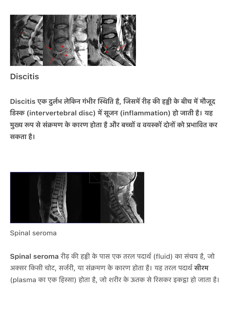 Spinal Cord Diagnosis | PDF