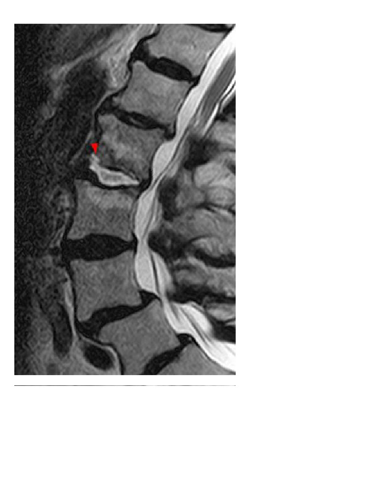 Spine Diagnosis | PDF