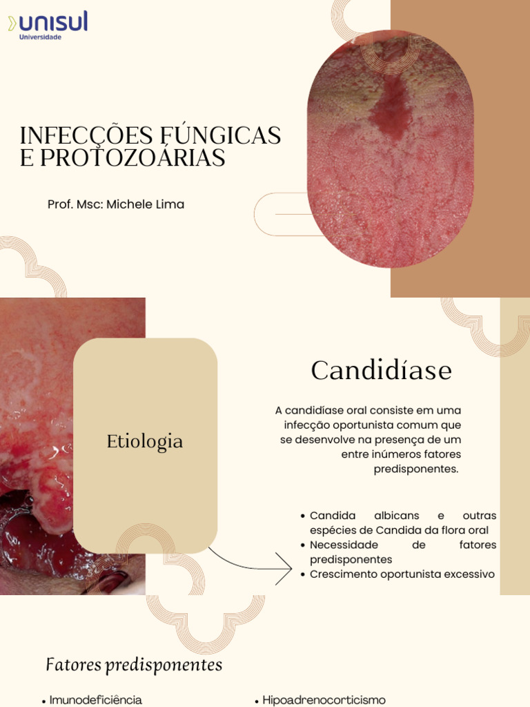 Infecções fúngicas | PDF | Candidíase | Boca