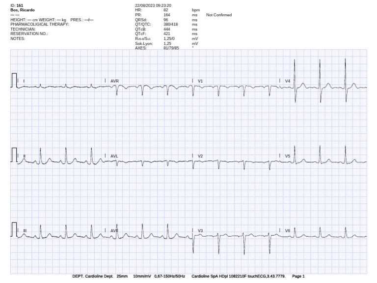 EKG Test Results Overview | PDF