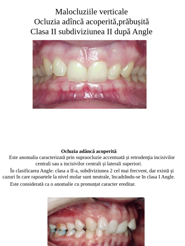 Ocluzia Adinca | PDF