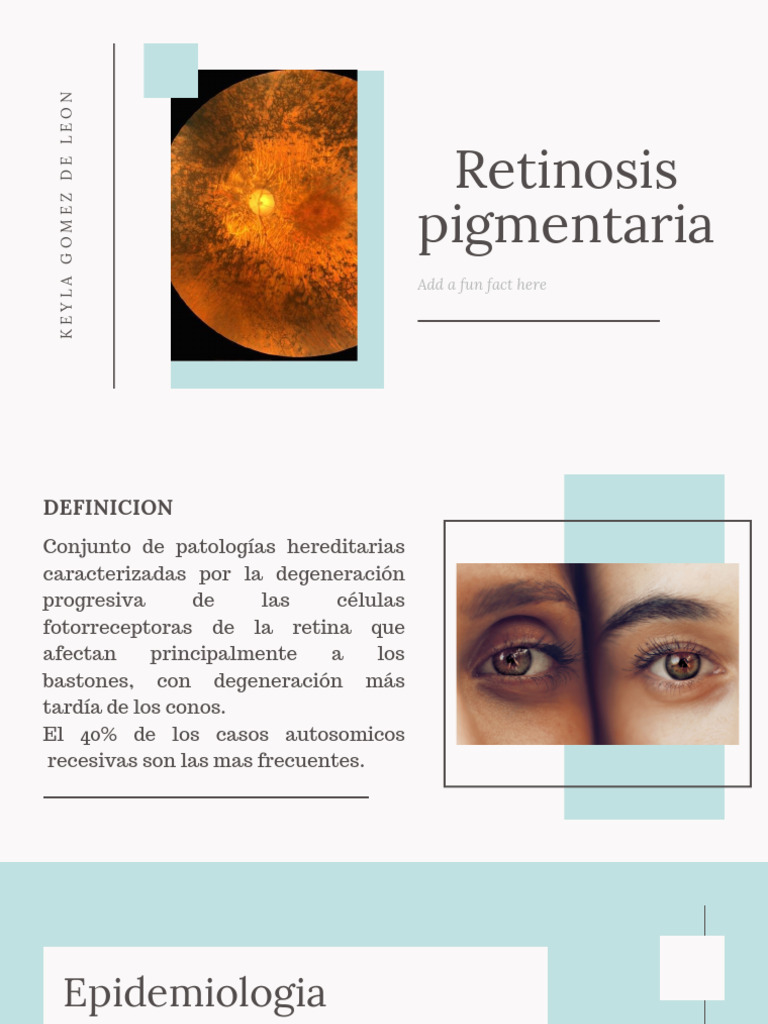 Retinosis Pigmentaria Keyla Gómez | PDF | Percepción visual ...