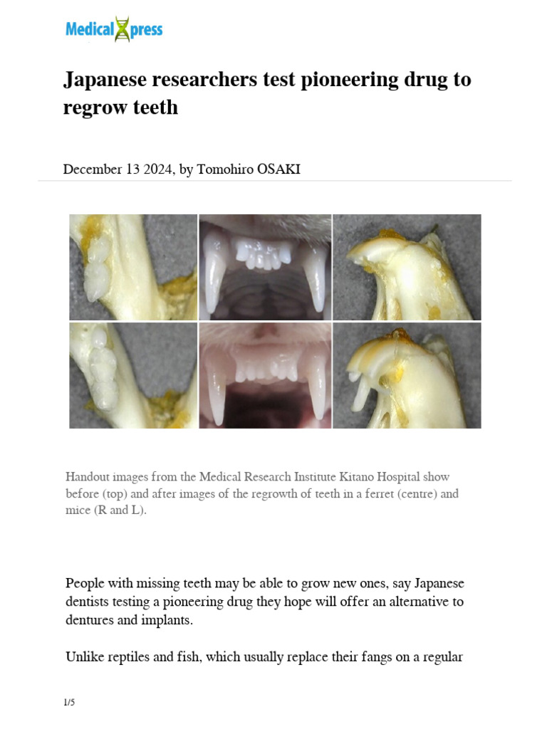 2024-12-japanese-drug-regrow-teeth | PDF | Dentistry | Tooth