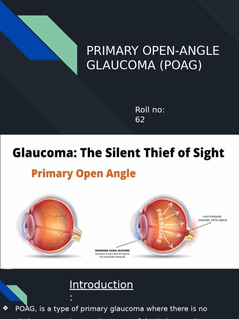 Primary Open Angle Glaucoma | PDF | Glaucoma | Human Eye