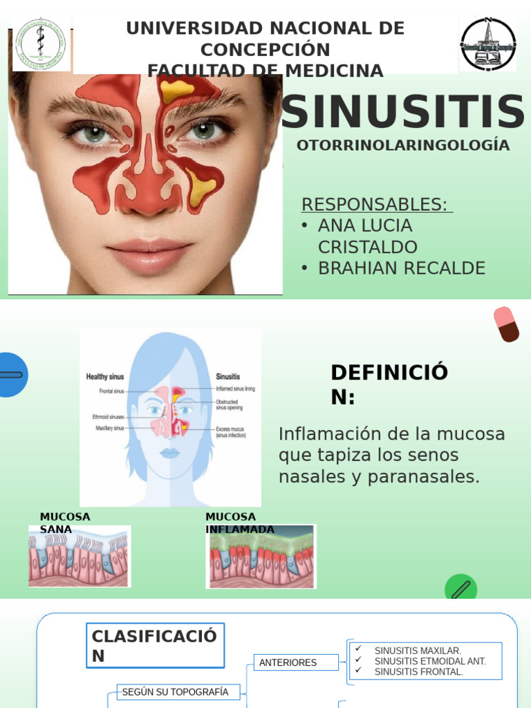 Clasificación y Tratamiento de Sinusitis | PDF | Inmunología | Medicina CLINICA