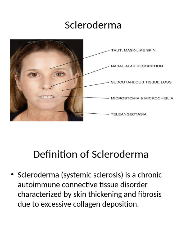 Scleroderma Presentation | PDF | Medical Specialties | Human Diseases ...