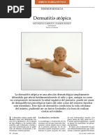 Tratamiento Dermatitis Atópica GPC | PDF | Alergia | Inmunología