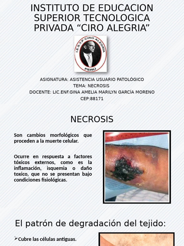 01 Necrosis | PDF | Inflamación | Biología Celular)