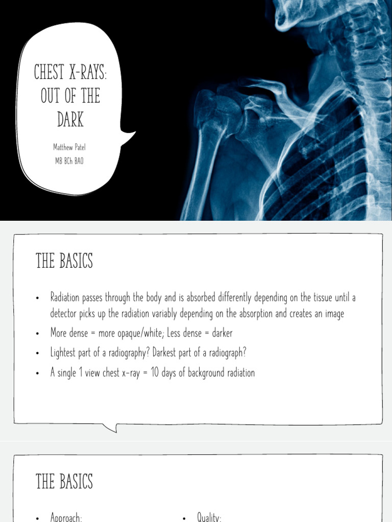 Chest X-Rays | PDF | Thorax | Respiratory Tract