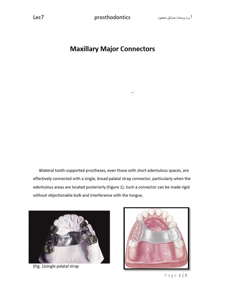 Prosthodontics 3 Maxillary Major Connectors | PDF | Dentistry Branches