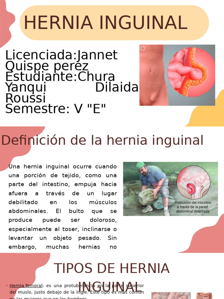 Hernia Inguinal | PDF | Abdomen | Estreñimiento