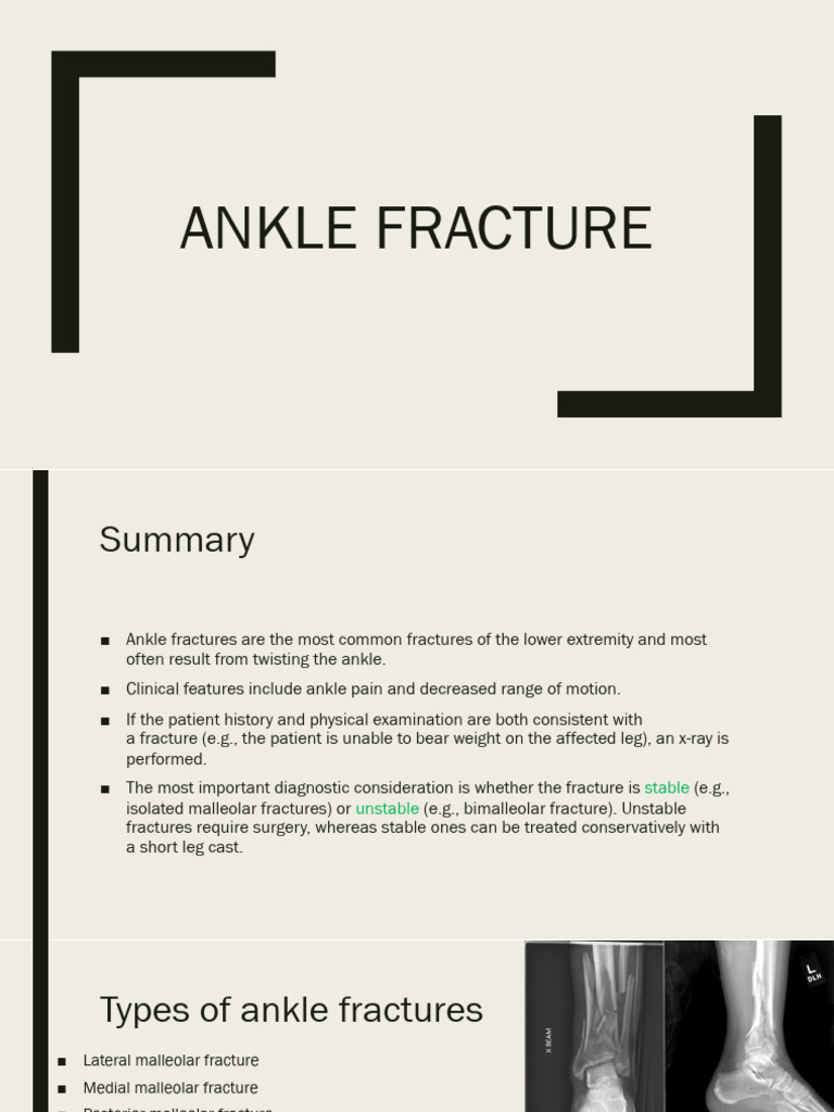 Ankle and Foot Fracture | PDF | Ankle | Limbs (Anatomy)