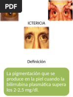 Diagnóstico de Ictericia y Coluria | PDF | Hígado | Gastroenterología