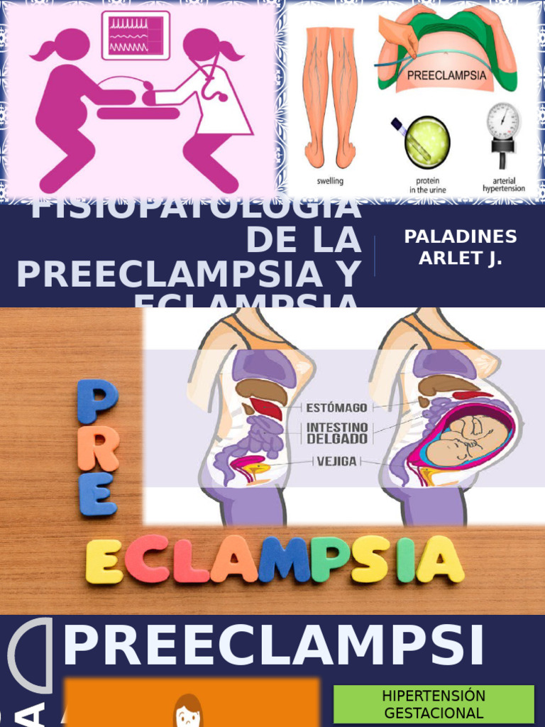 Preecampsia Eclampsia | PDF