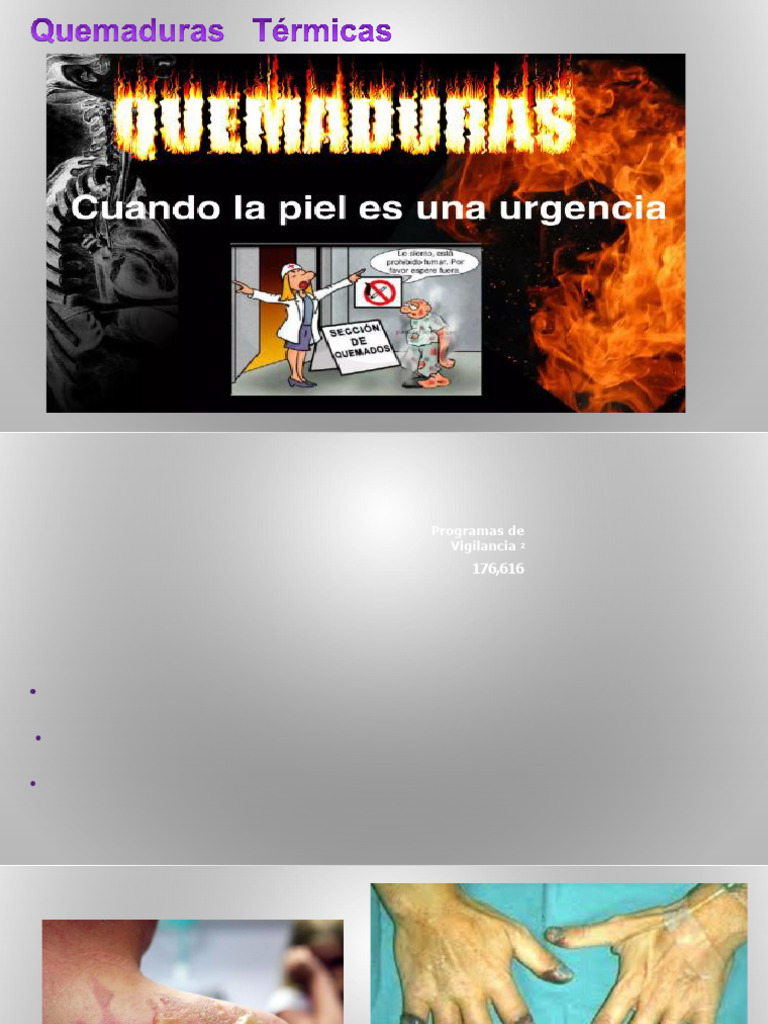 9 Quemaduras Termicas y Muerte Por Electricidad | PDF | Quemar | Hueso