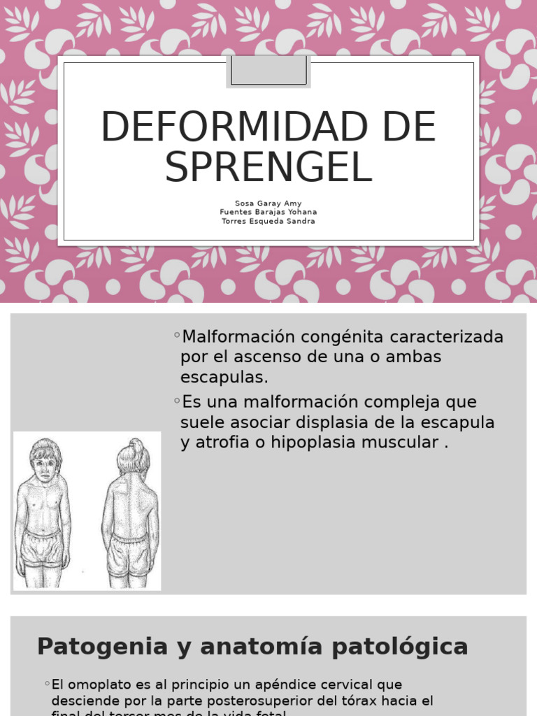 Deformidad de Sprengel: Causas y Tratamiento | PDF | Hombro | Sistema ...