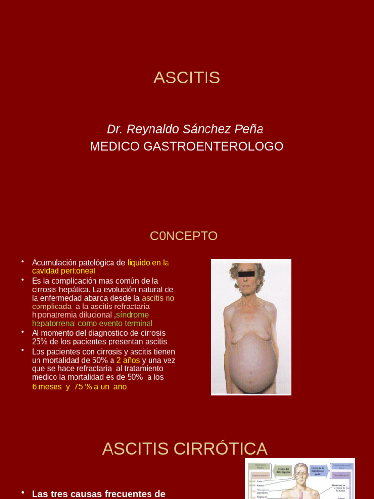 Ascitis - Encefalopatia | PDF | Cirrosis | Especialidades Medicas